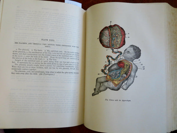 Dr. Hollick's Complete Works Marriage Guide Reproduction Diseases 1902 ...
